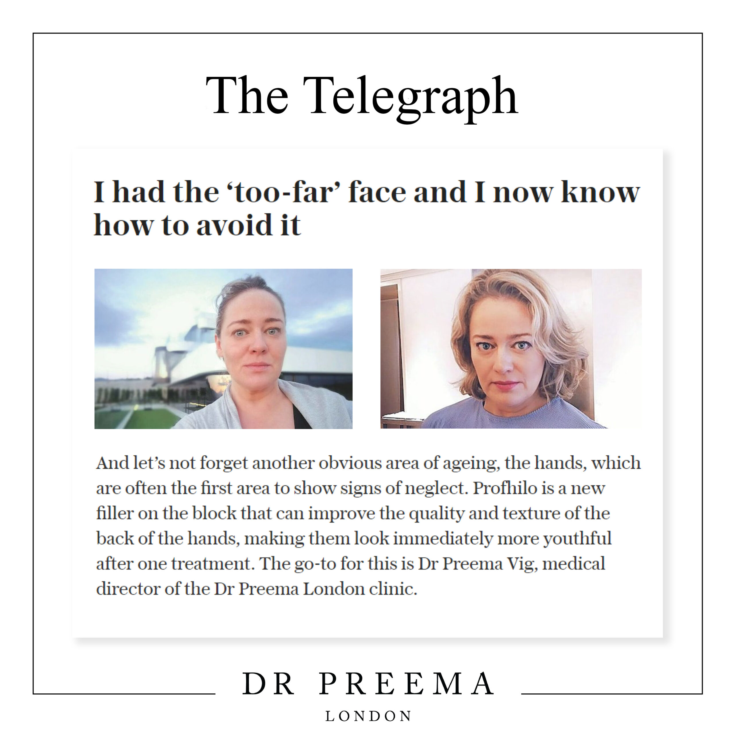 The Telegraph - How to avoid the "Far Face" - Dr Preema London Clinic