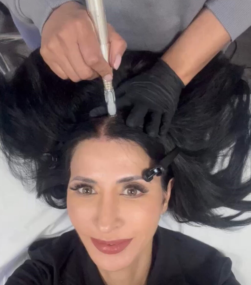 Calecim® Stem Cell Hair Treatment at Dr Preema London Clinic uses a ...